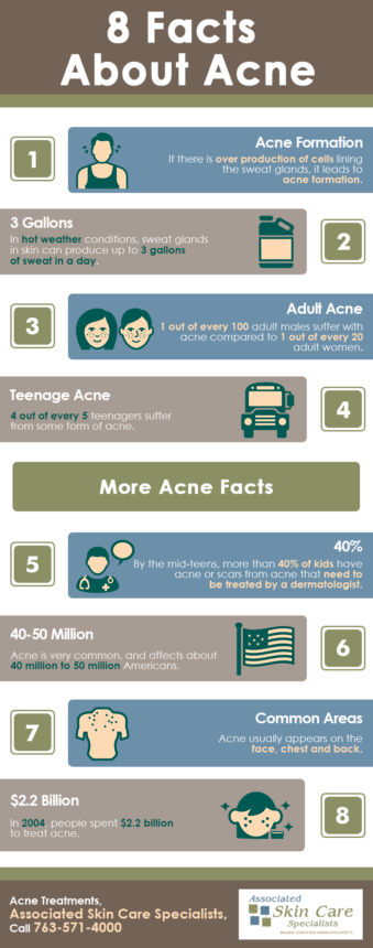 8 Facts About Acne | Shared Info Graphics